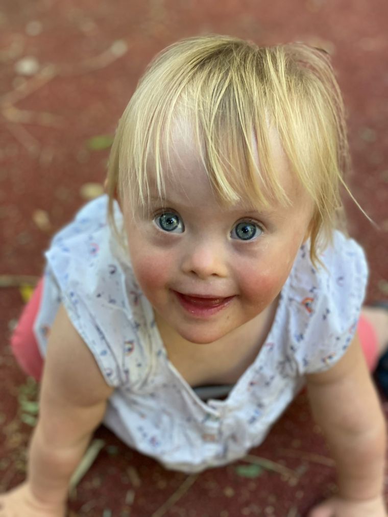 Quels sont les caractéristiques de la trisomie 21?